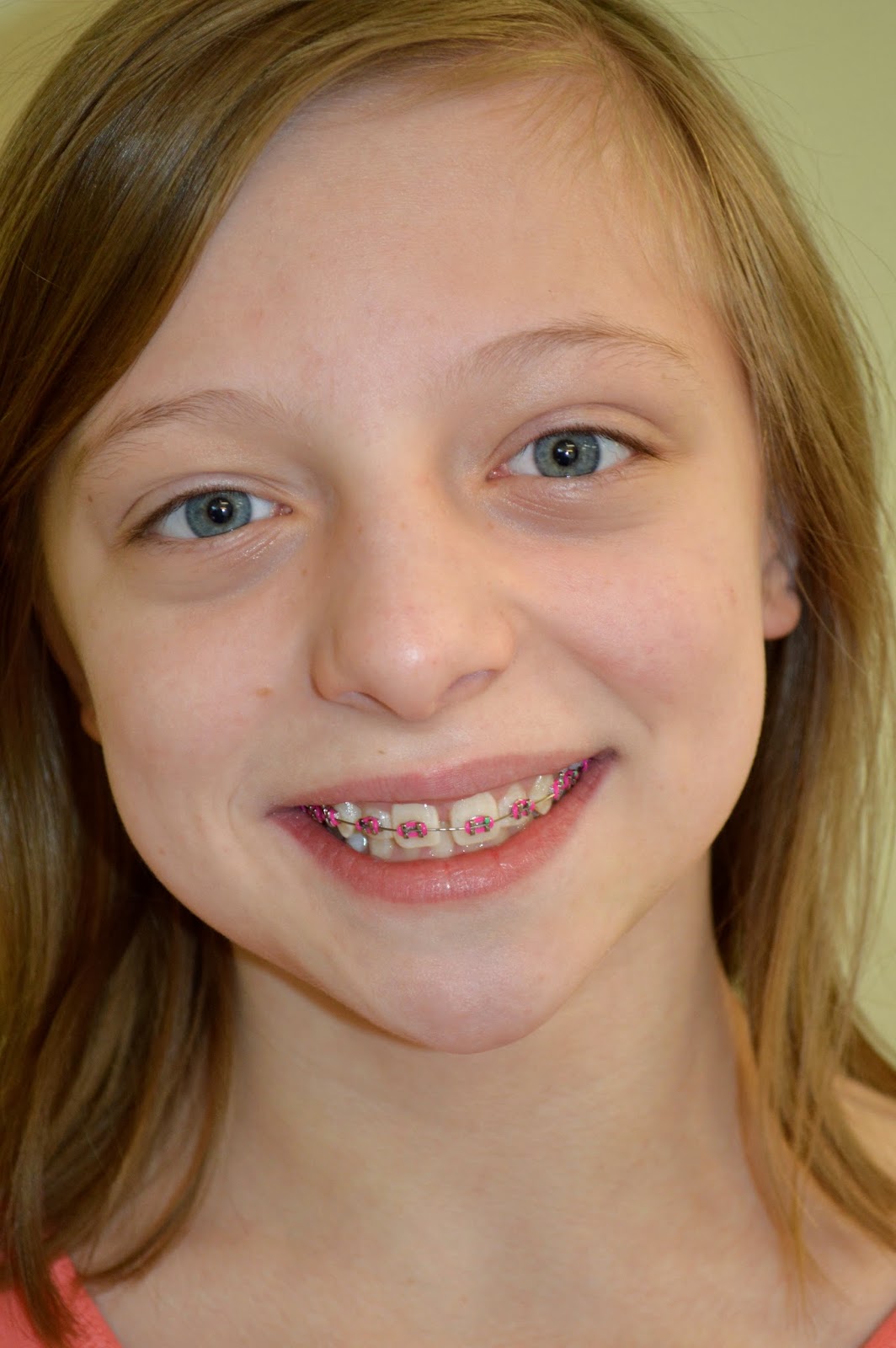 Starting Over Picking Up the Pieces: Hannah Got Braces!