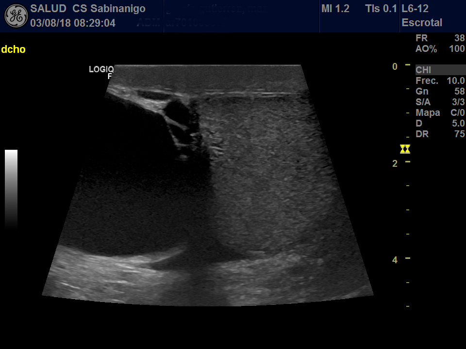 Ecografía en Atención Primaria
