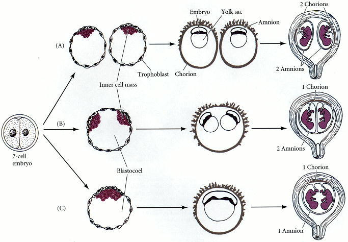 The Merrick Twins: All about twins!