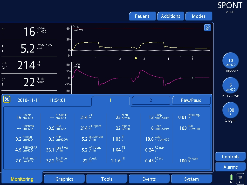 FREMITUS: Obtaining P0.1 on Various Ventilators