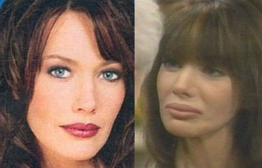 Hunter Tylo Surgery
