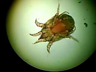 Enfermedades Cutáneas: Sarna