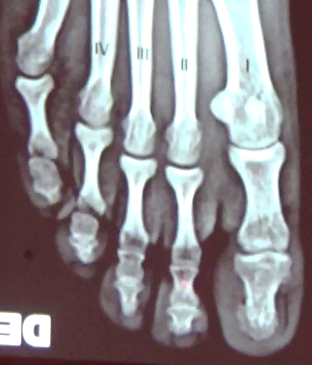 RADIOANATOMIA: QUINTA CLASE