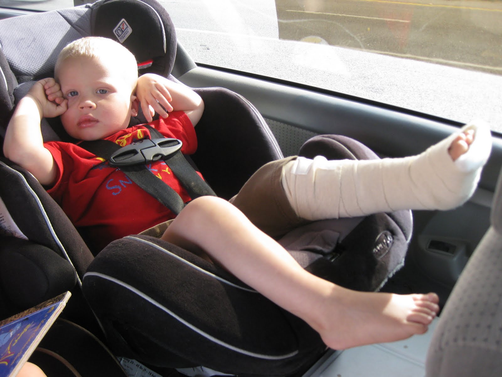 Devin & Ruthann Family: Broken Leg Pics