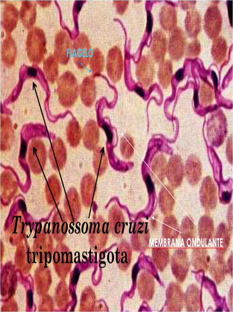 Trypanosoma cruzi - Parasitologia