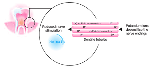 Dental Perception: Tooth Sensitivity ....commonest dental problem