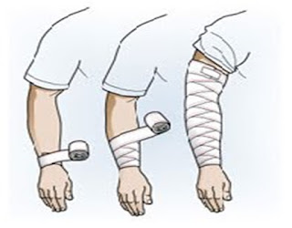 Primeros Auxilios: Vendajes