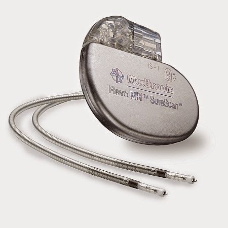 Cuando tu Corazón pierde el Ritmo...: Tipos de Marcapaso