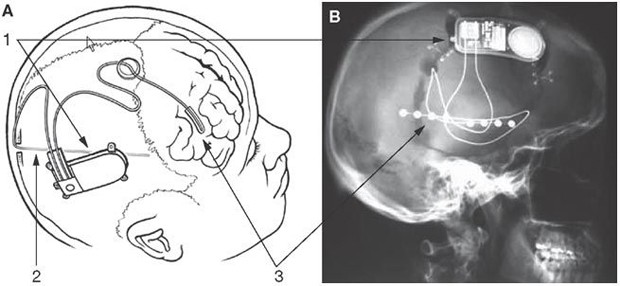 Grupom Blog: Inovação - 30 startups para você ficar de olho em 2018.