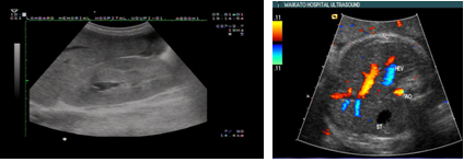 radiologi oh radiologi: USG ( ultrasonography)