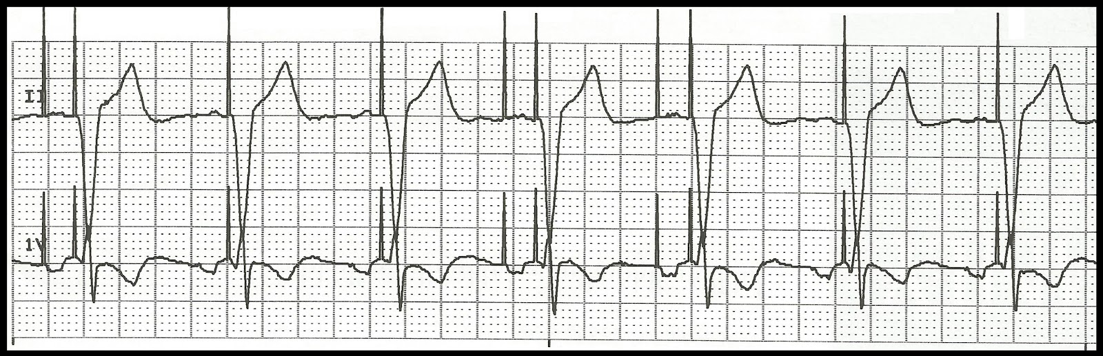 EKG Rhythm Strip Quiz 108