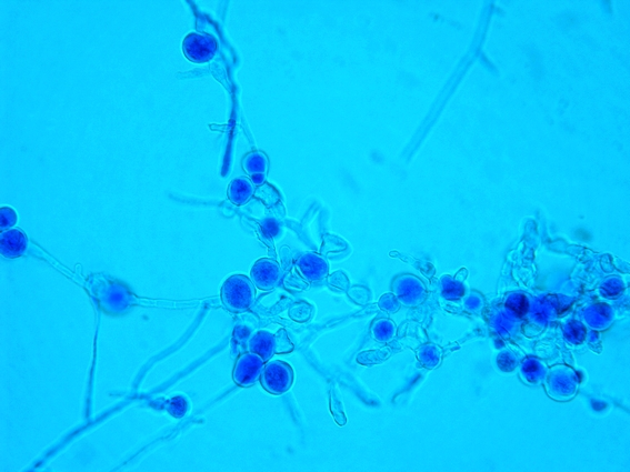 Fun With Microbiology (What's Buggin' You?): Epidermophyton floccosum