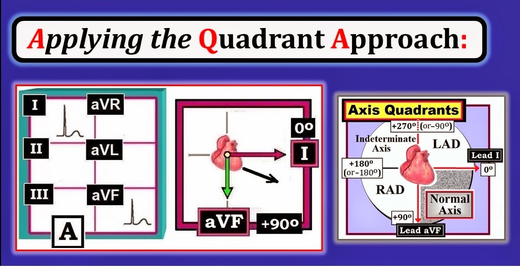 ECG Interpretation: ECG Blog #90 (Basic Concepts-3) – AXIS
