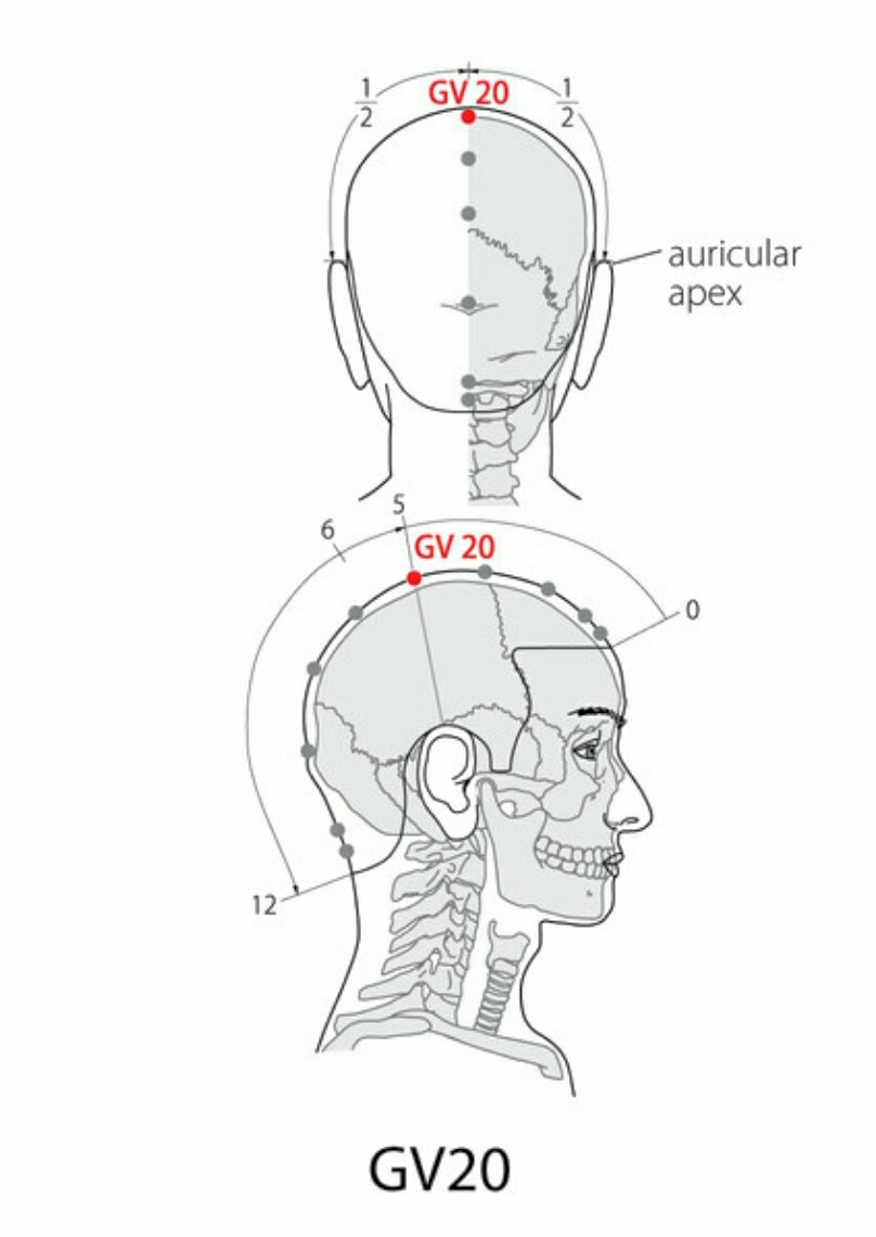 SaroEpic Acupuncture : 2016