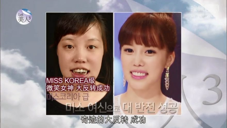 Let Me In - A korean Plastic Surgery Variety TV Show - Just An Ordinary ...