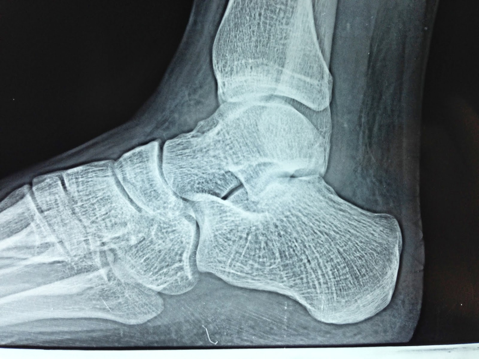 Cirugía Ortopédica y Traumatología Avanzada - Dr. Ricardo Casal ...