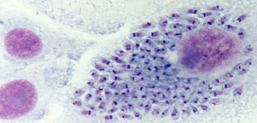 Trypanosoma cruzi - Análises Clínicas.com