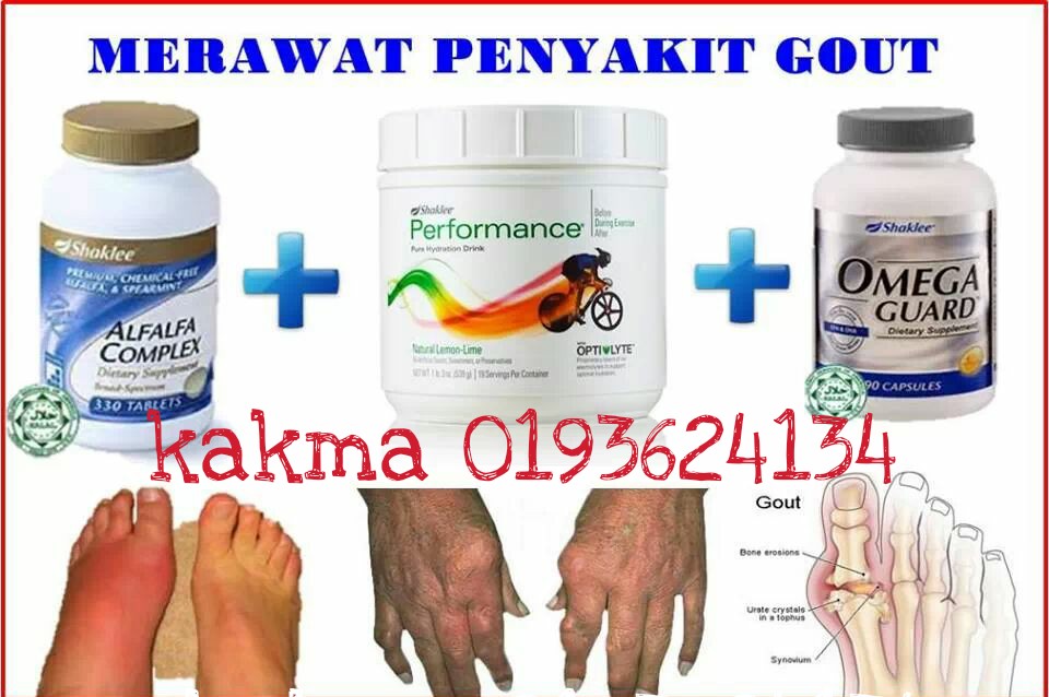KakmaStory: SAKIT GOUT , KENALI TANDA - TANDA DAN CARA RAWATAN SAKIT GOUT