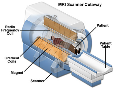 Creatio ex Nihillo: Roentgen, MRI, CT scan, USG --> Apa beda dan ...