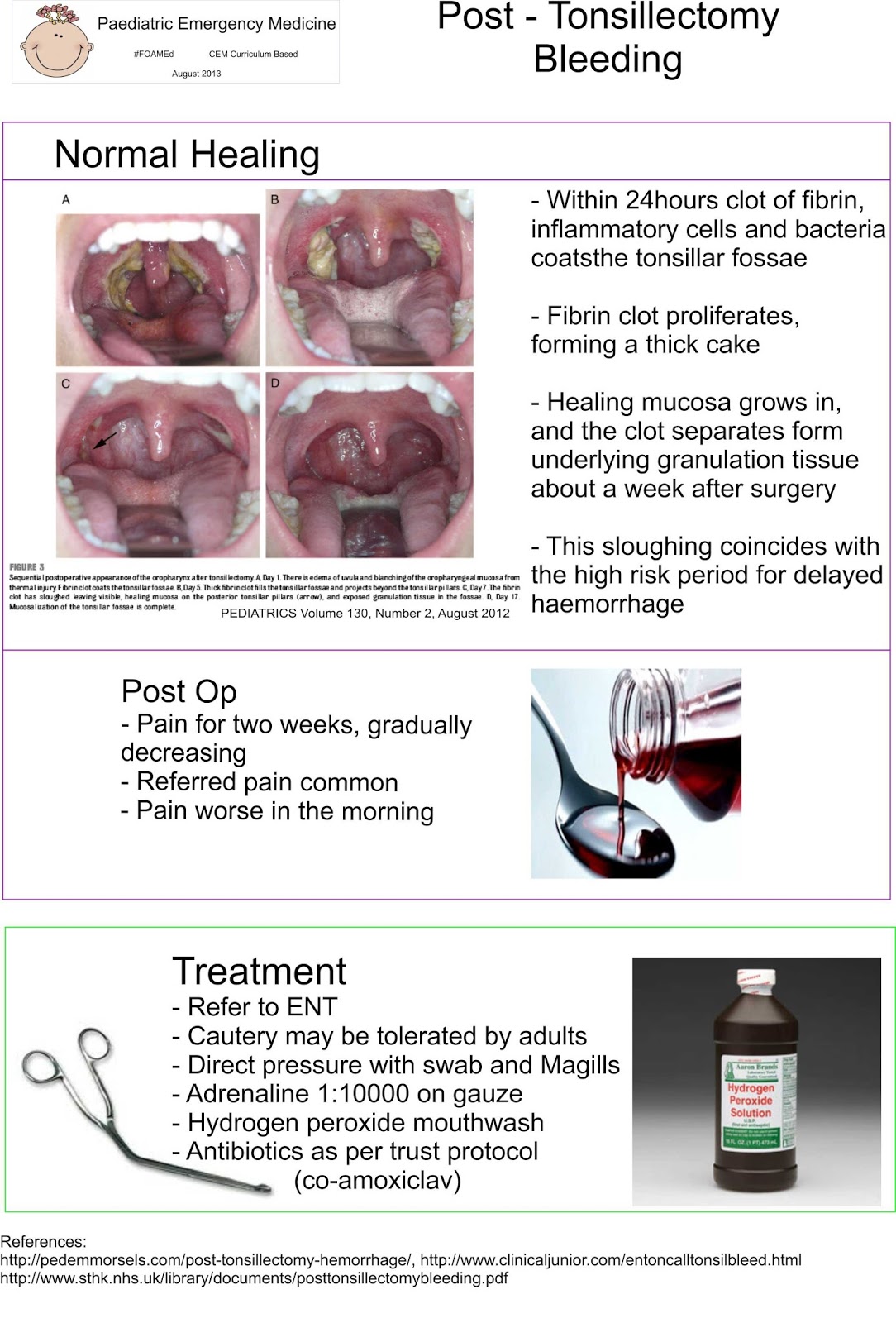 Paediatric Emergency Medicine: Post Tonsillectomy Bleeding