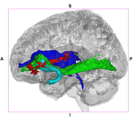 Minding the Brain: Mapping the language system: Part 2