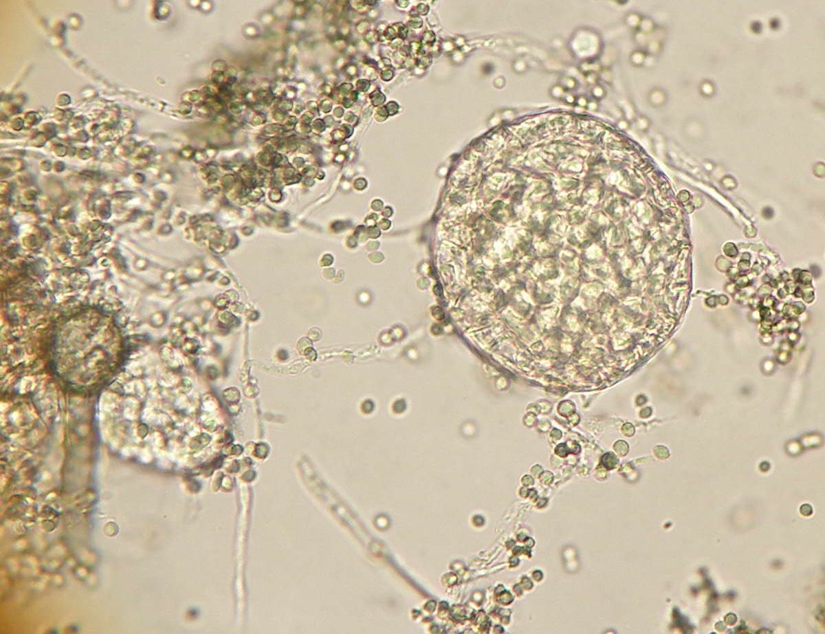 ATLAS MICOLOGIA: ASPERGILLUS GLAUCUS