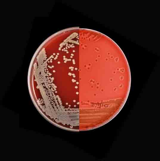 Teenoz Health Analyst: IDENTIFIKASI KLEBSIELLA