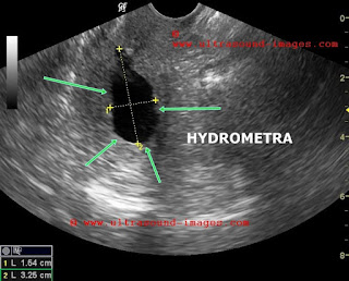 Ultrasound imaging: March 2018