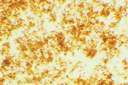 [Haematology] Microscopic Examination of Urinary Sediment - Crystals ...
