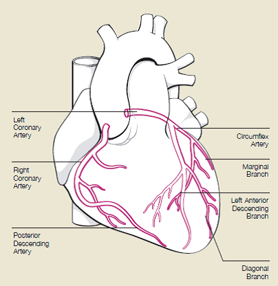 CORONARY ARTERY DISEASE (CAD)