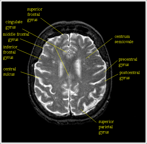 Brain Interactive: White matter