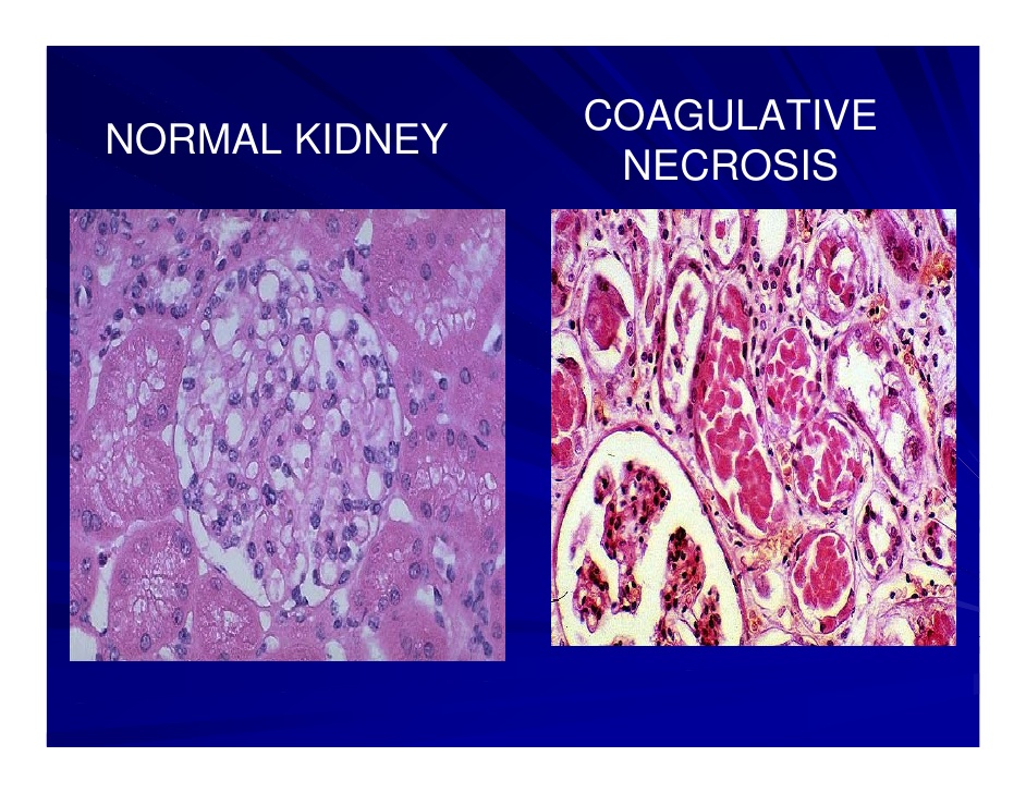 Lecture Notes in Medical Technology: Lecture #2: Mechanism of Cell Damage