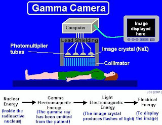 BIOMEDICAL ENGINEERING: Gamma cameras