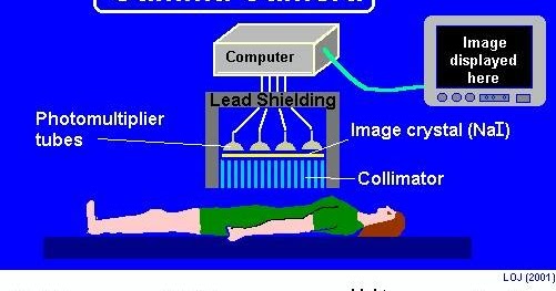 BIOMEDICAL ENGINEERING: Gamma cameras