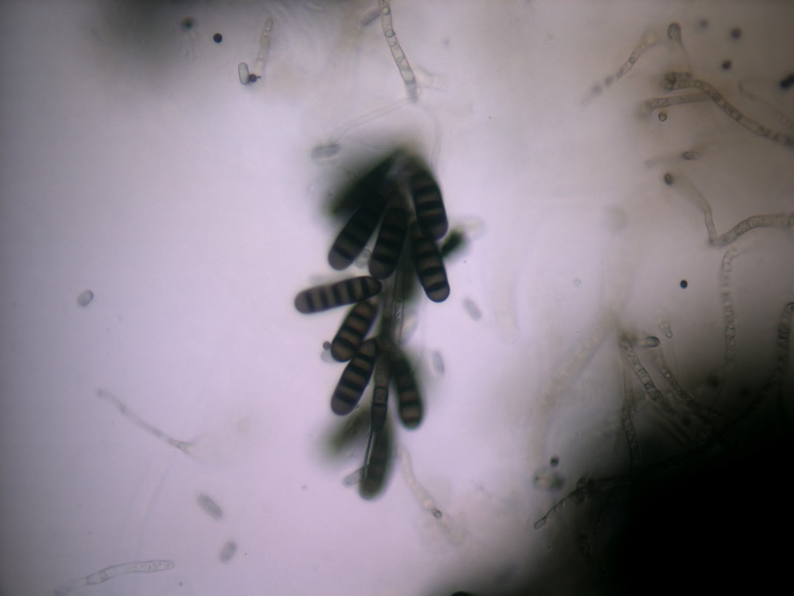 MaxwellHandiseniPLPA631: Lab 5: Conidiating Fungi