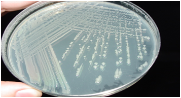 MICROBIOOLOGIA Y PARACITOLOGIA : Enterobacter aerogenes