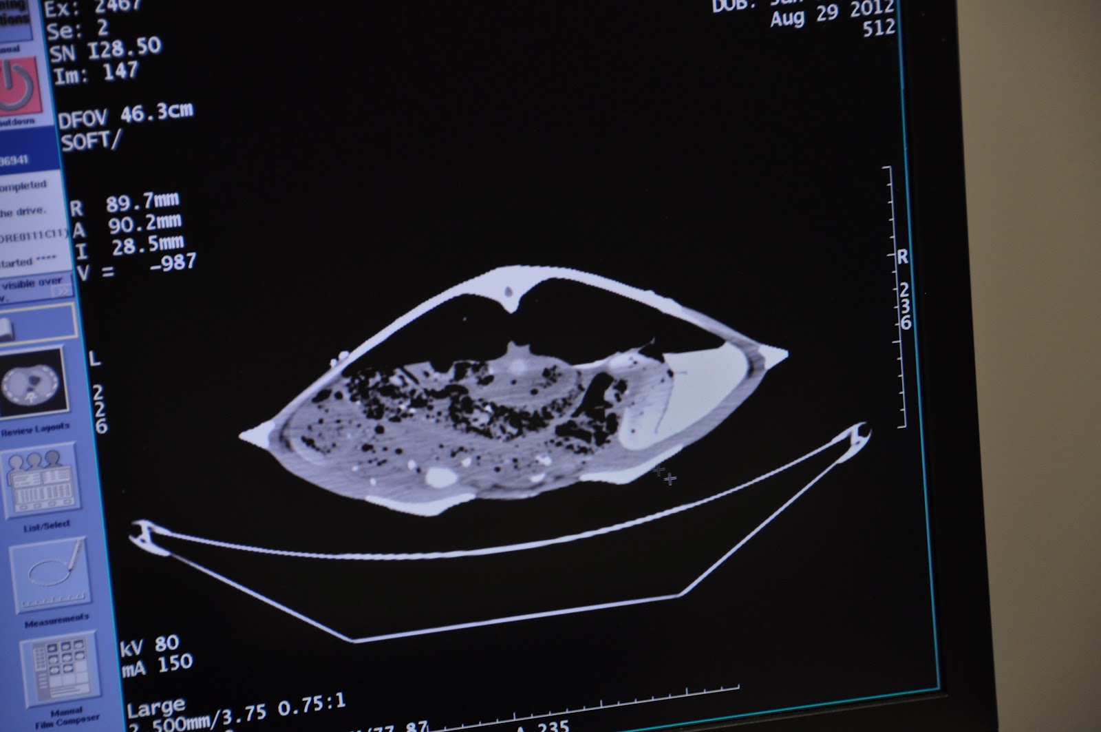 Sea Turtle Hospital: Green Sea Turtle Admitted with Severe Intestinal ...