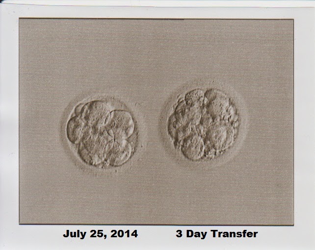 4 P's in a Pod: IVF #2 Embryo Transfer Day