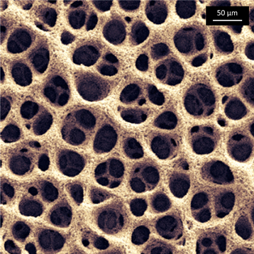 Micro-supercapacitors with lithium battery energy and supercapacitor ...