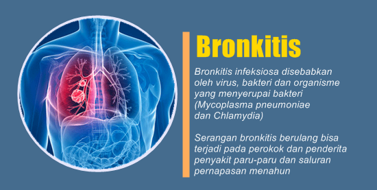 Bronkitis - Masalah Kesehatan