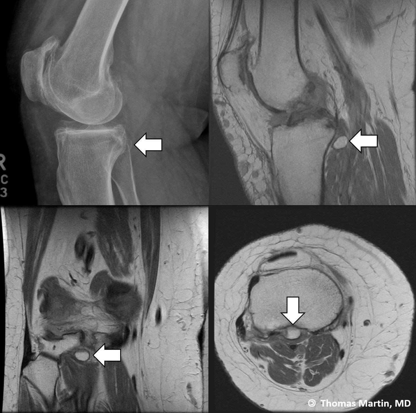Roentgen Ray Reader: Cyamella
