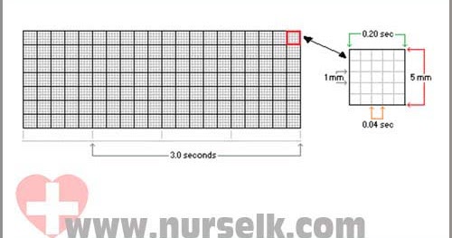 How to read an Electrocardiogram (ECG) - Part 2, ECG Graph ...