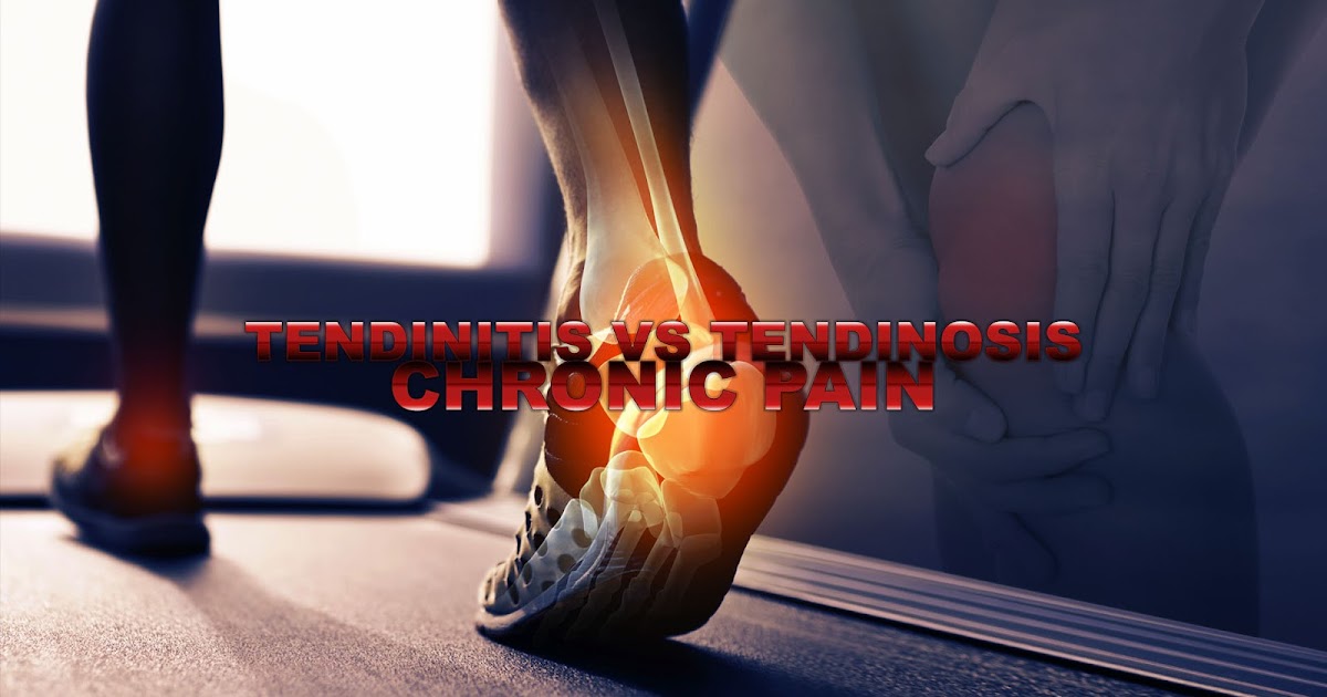 Tendinitis vs Tendinosis | Chronic Pain