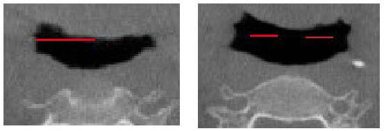 Facial Development Newsletter: Nasal and Oropharyngeal Airway ...