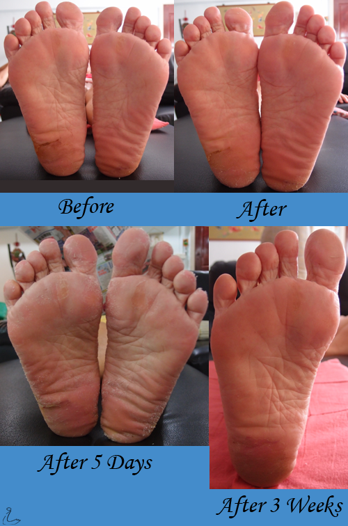 The Swanple: Review: Milky Foot Intense Exfoliating Foot Pad