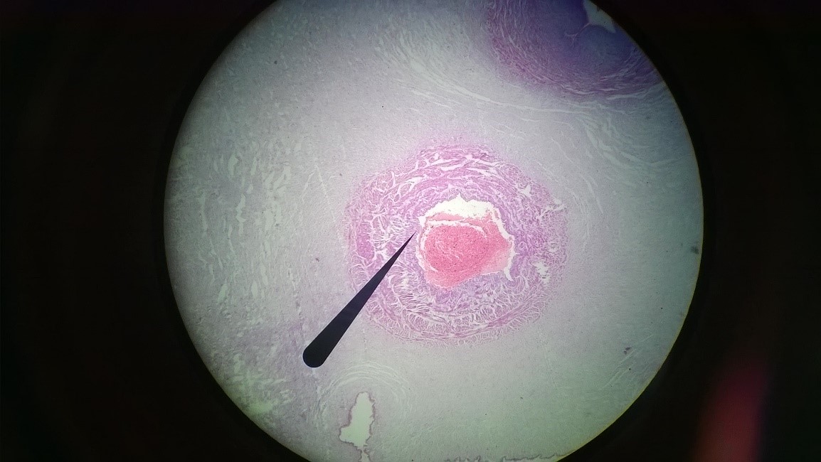 Histología: Tejido Conjuntivo Laxo
