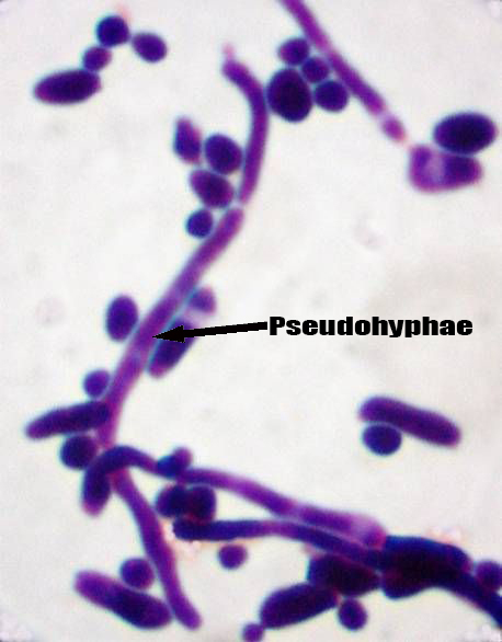 Fungal Structures and Mycology Terminologies Essential for ...