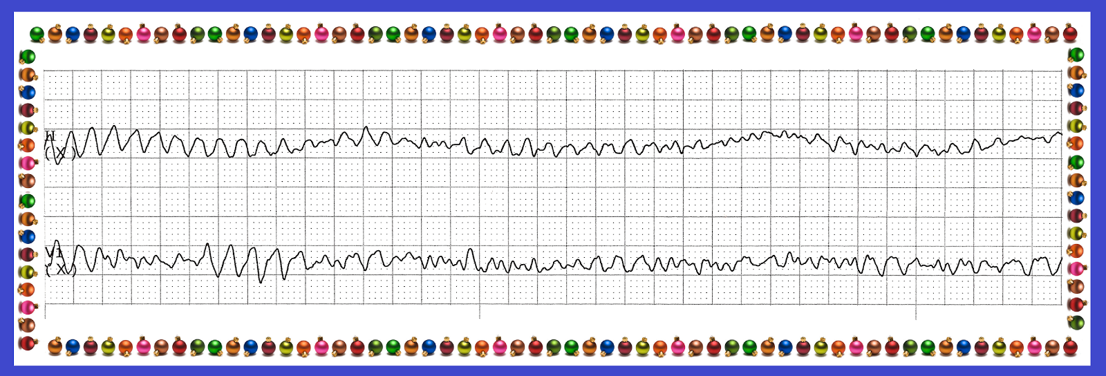 Practice EKG Strips Merry Christmas