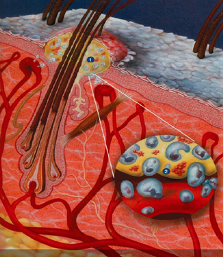 Dermatologia Veterinária: PIODERMITES EM CÃES - NOVO!