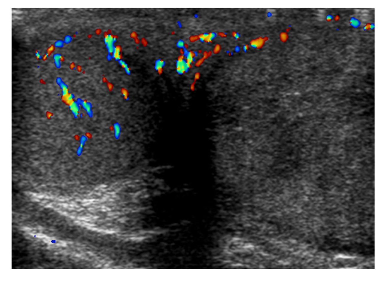 Doctors Gates: Management of a case of scrotal pain and swelling testis